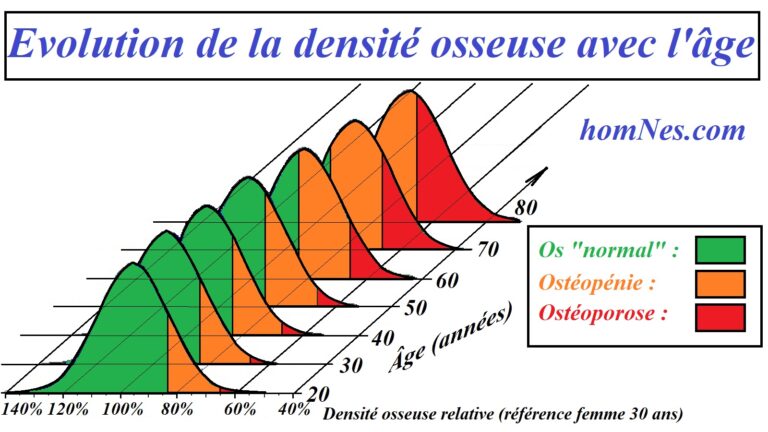 T-Score, Z-Score - Ostéoporose, Ostéopénie (ostéodensitométrie)